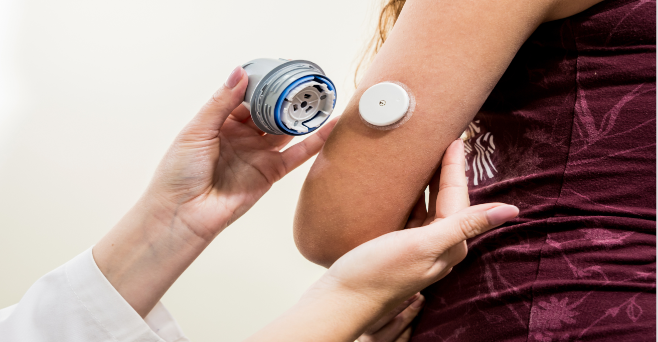 Cómo colocar el sensor Freestyle Libre CGM